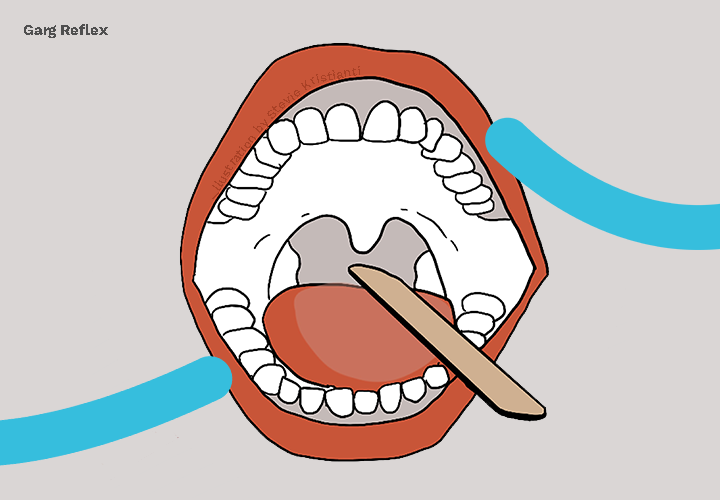 Penanganan Kegawatdaruratan Dislokasi Temoromandibular Joint (TMJ)