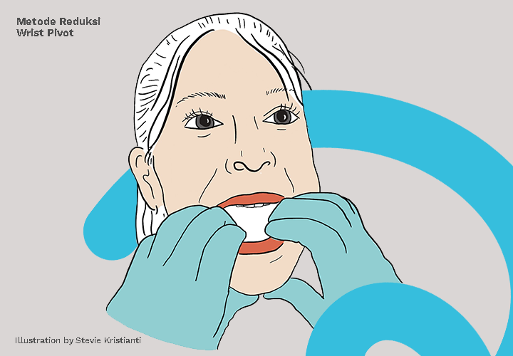 Penanganan Kegawatdaruratan Dislokasi Temoromandibular Joint (TMJ)