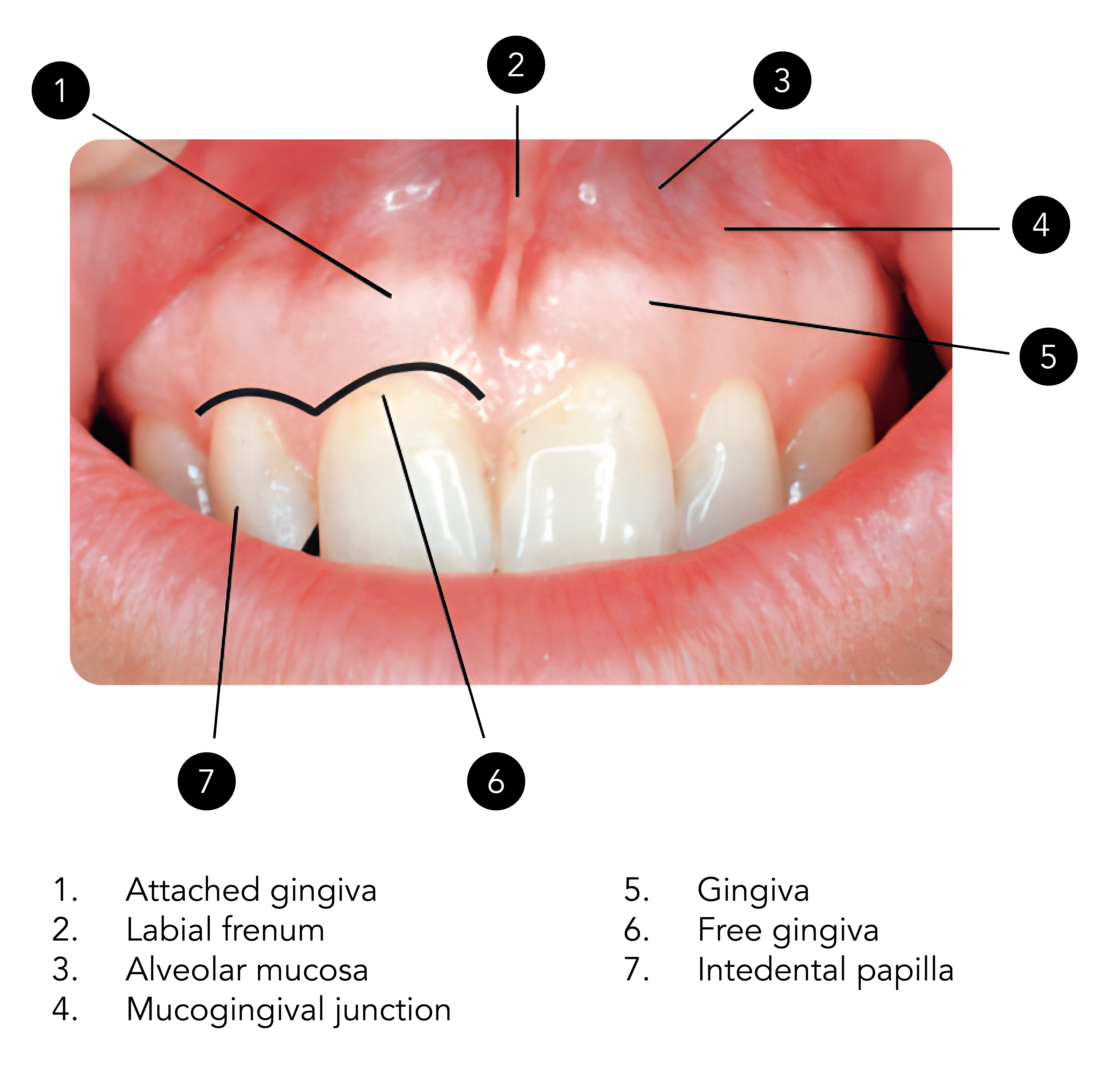Aspek Histologis Dan Biokimiawi Gingiva