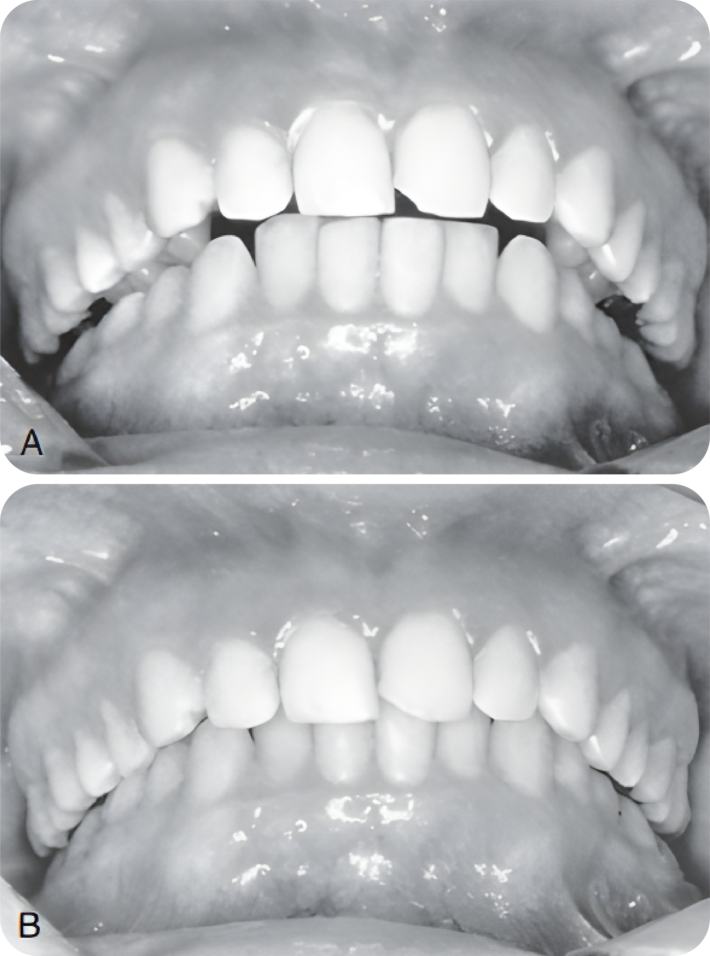 Relasi dan oklusi gigi