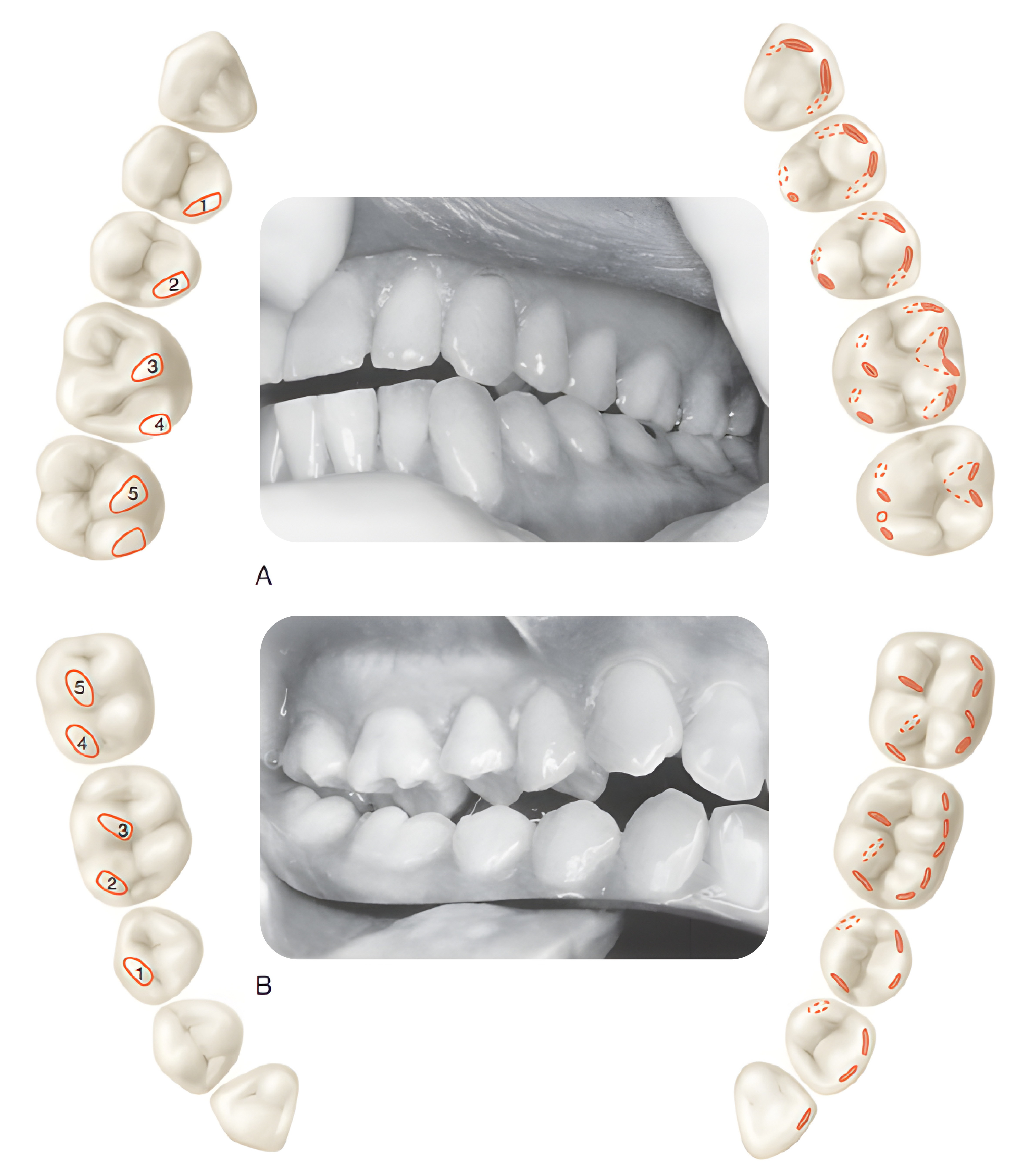 Relasi dan oklusi gigi