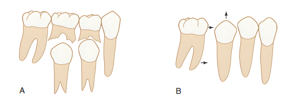 Relasi dan oklusi gigi