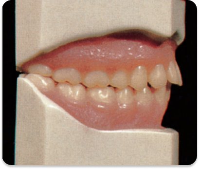 Relasi dan oklusi gigi