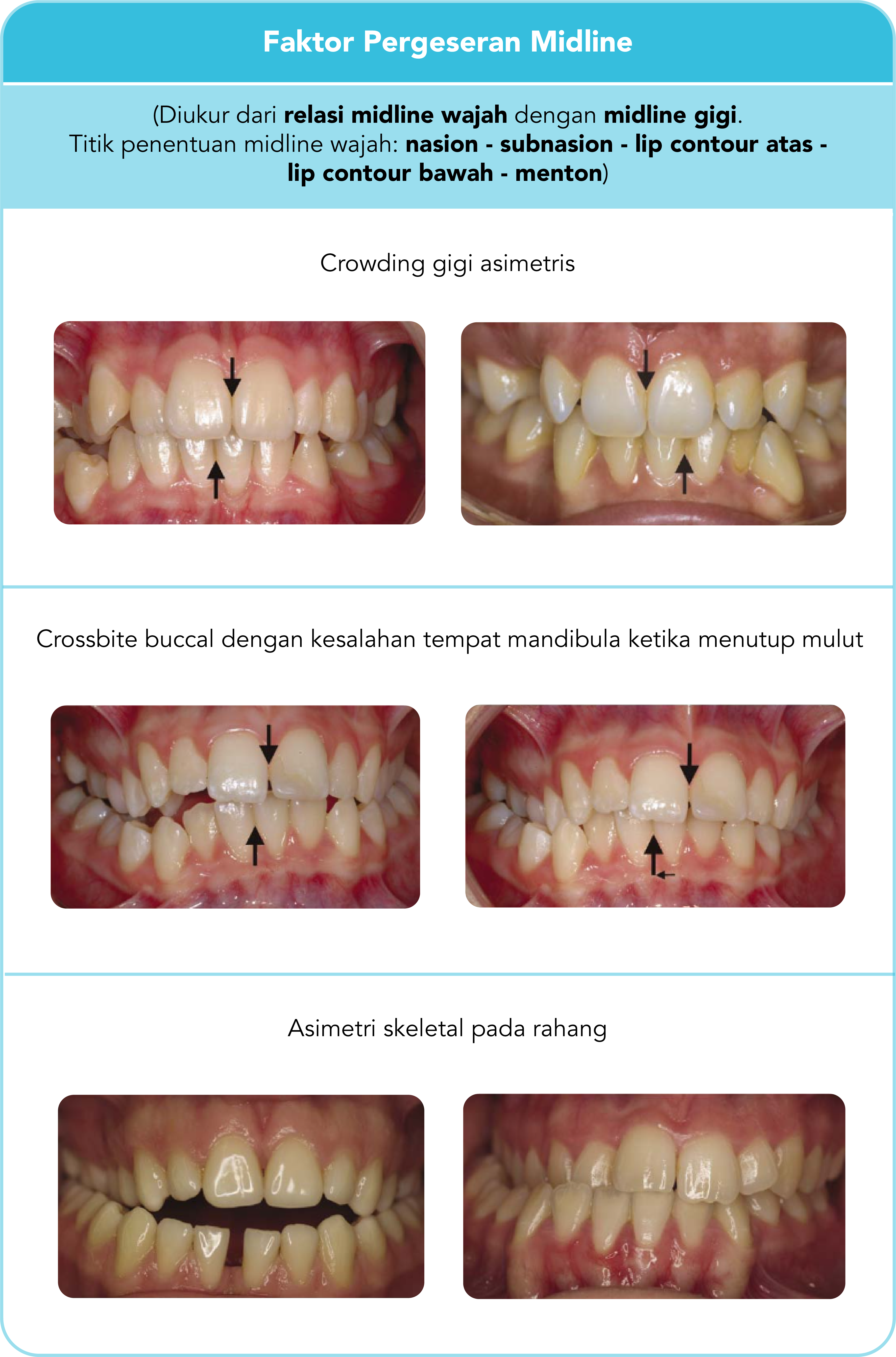 Analisa Intraoral dan Ekstraoral