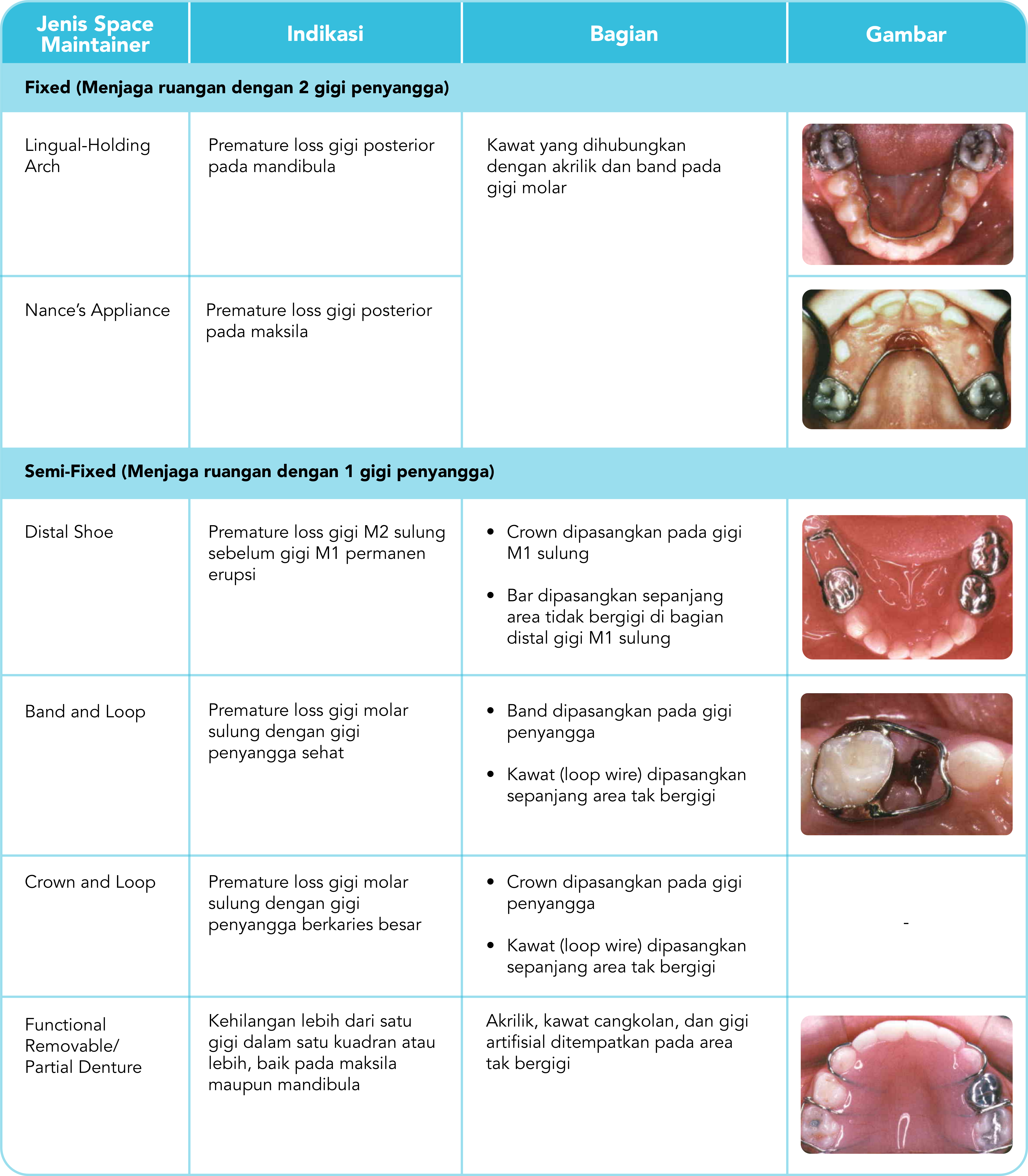 Space Maintainer dan Space Regainer