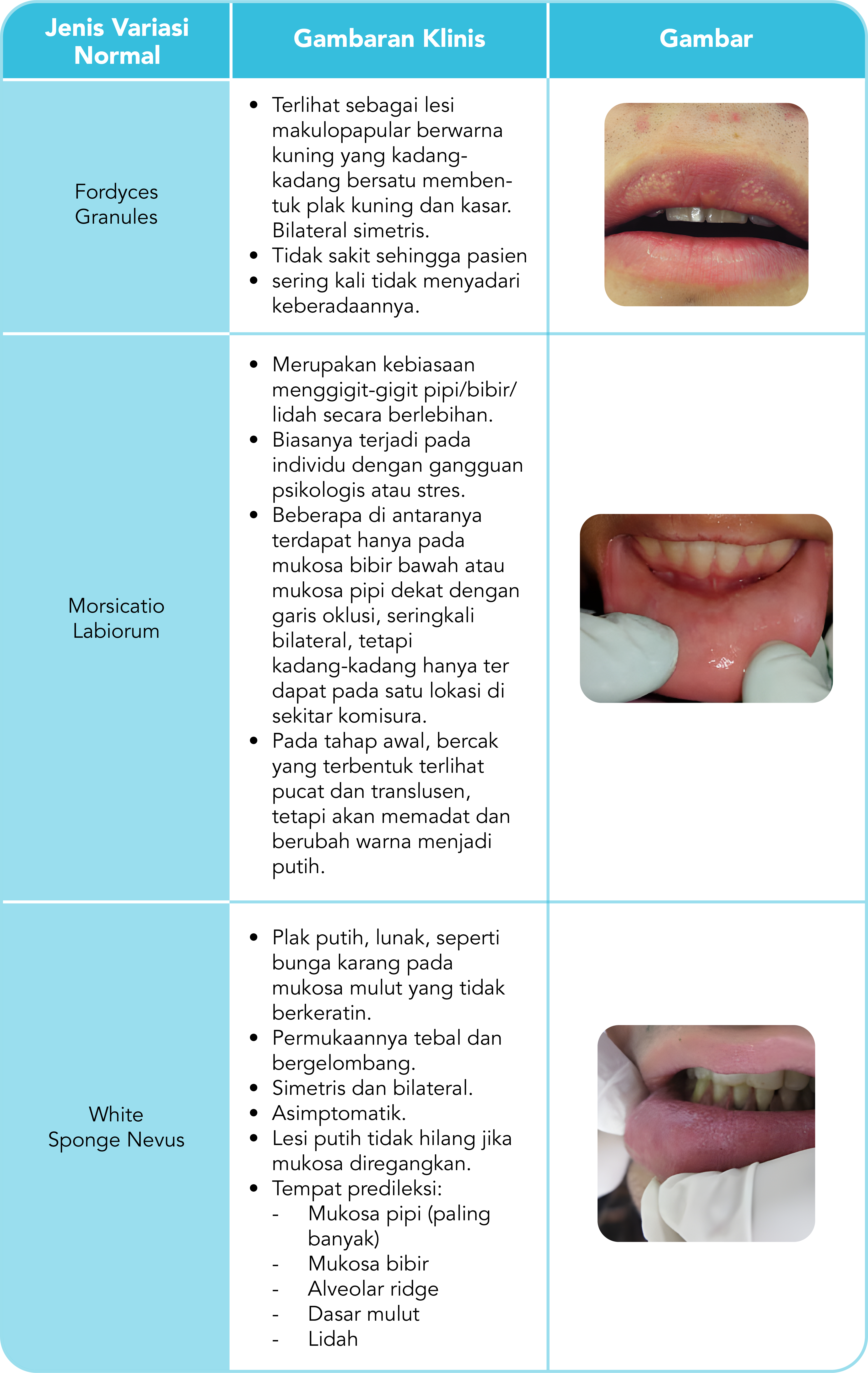 Varian Normal Rongga Mulut