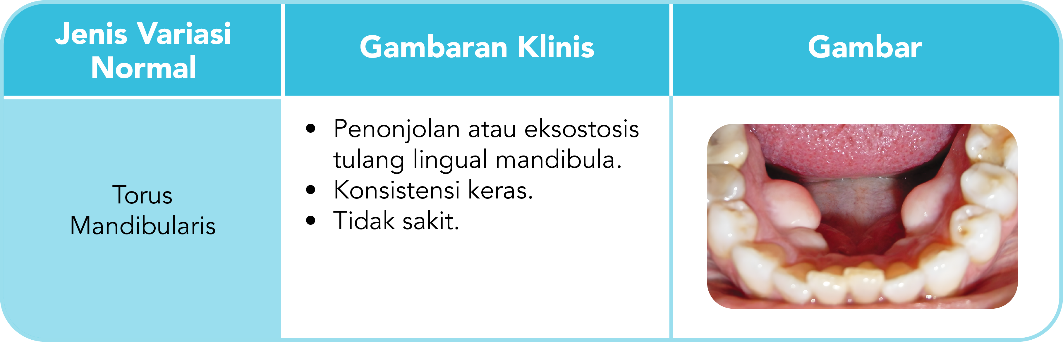 Varian Normal Rongga Mulut