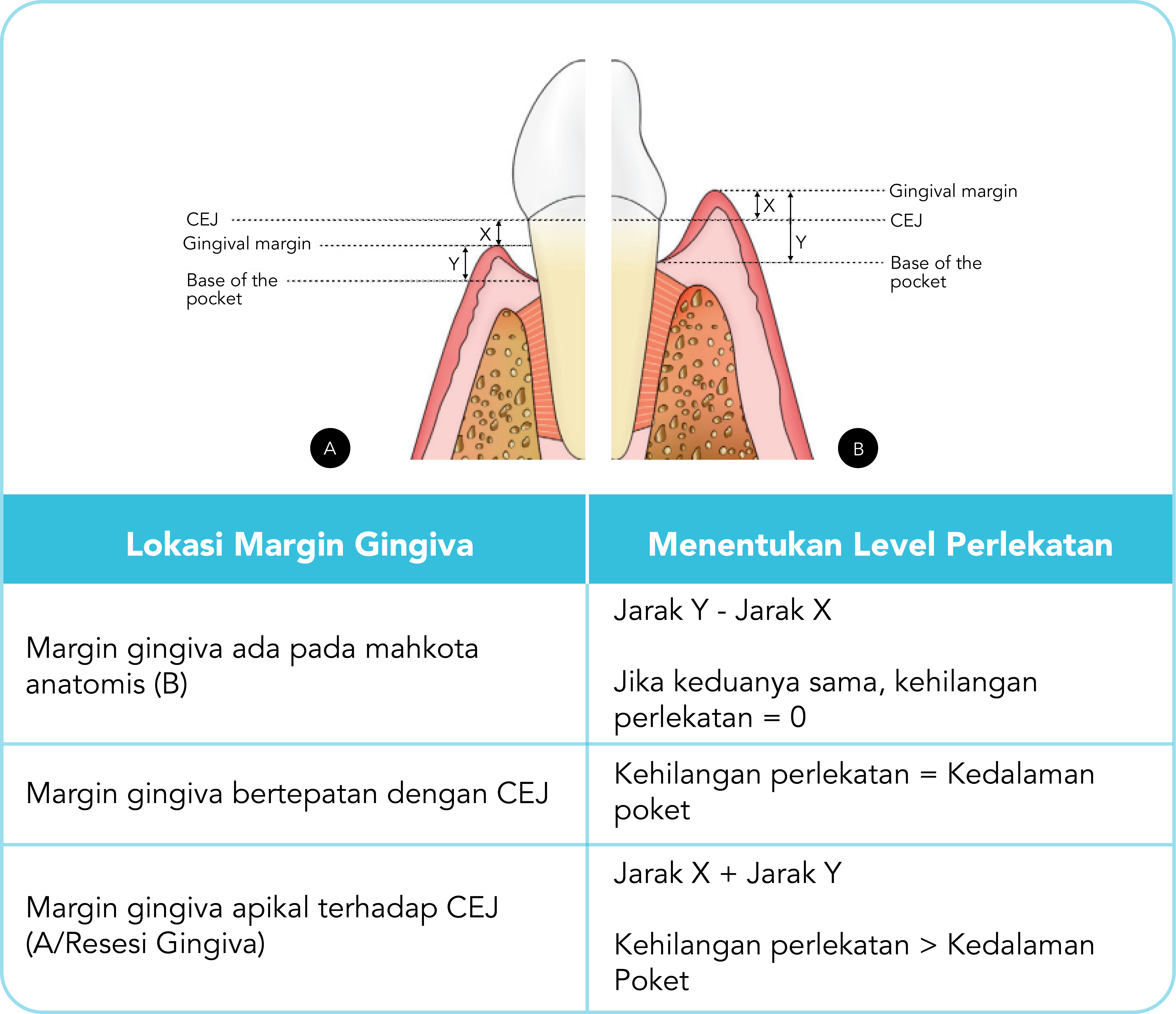 Periodontal Disease Assessment (Periodontal Chart)
