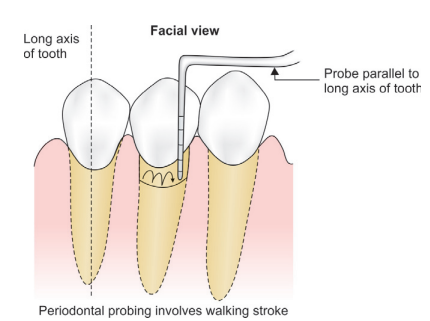 Periodontal Disease Assessment (Periodontal Chart)
