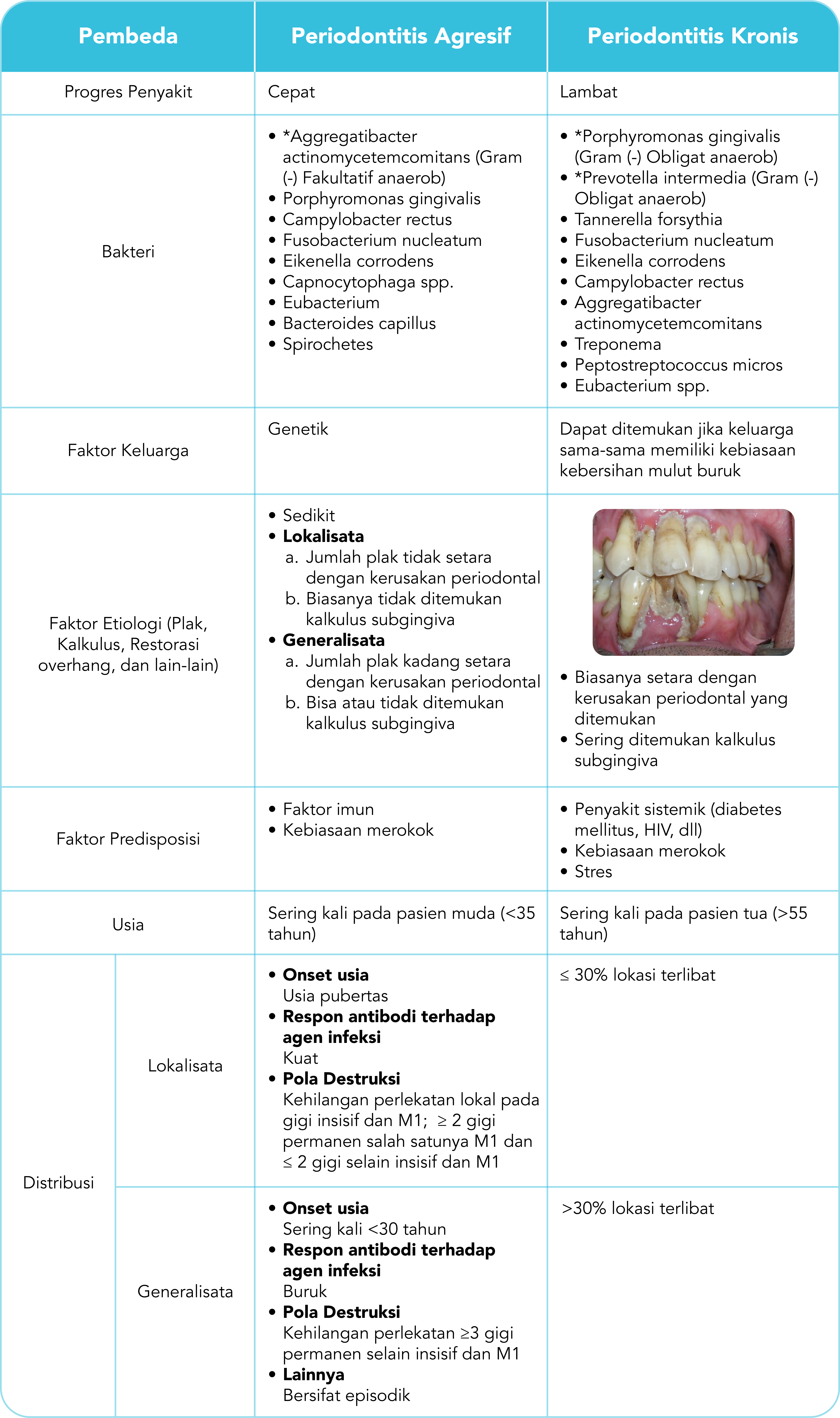 Periodontitis