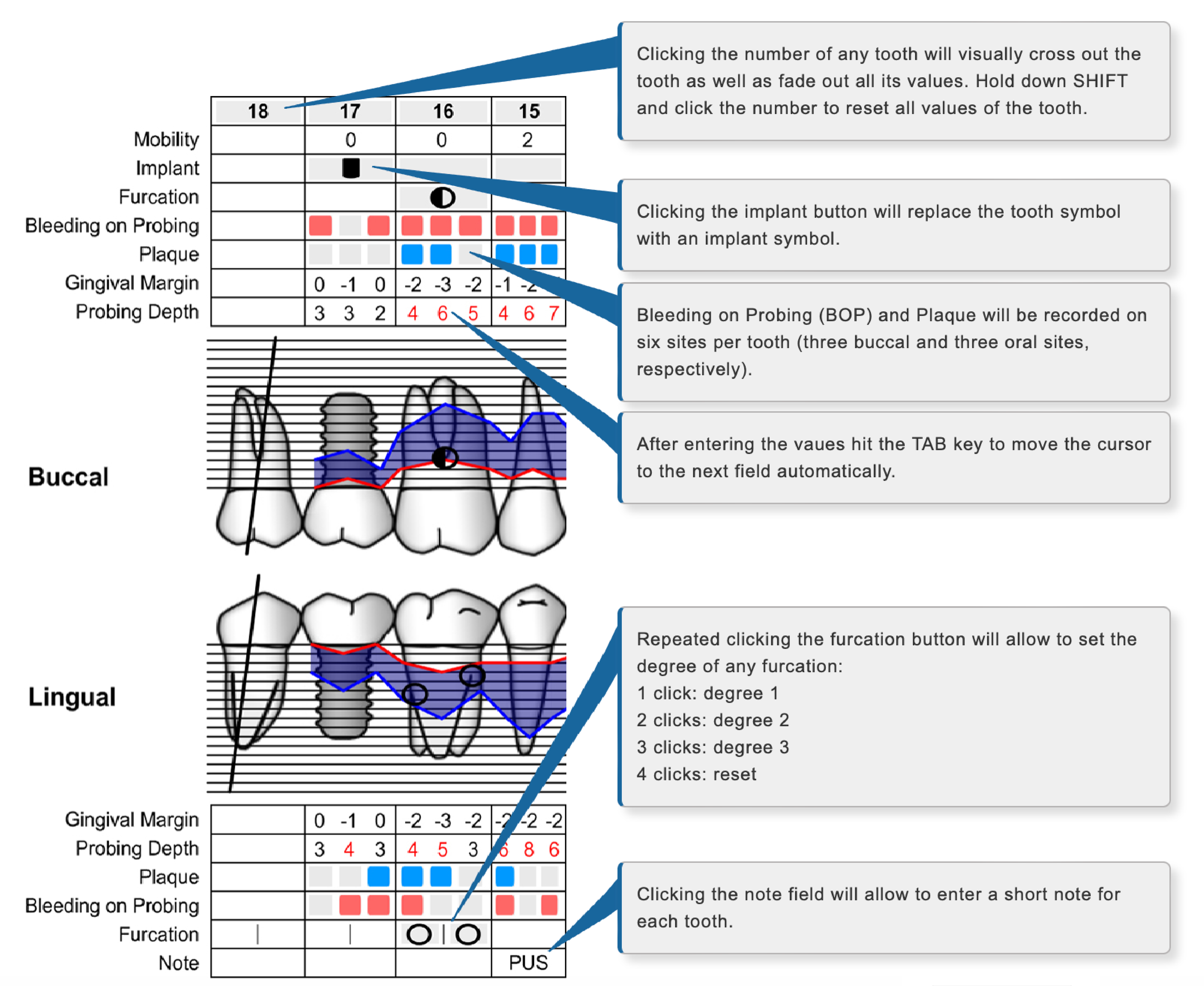 Periodontal Disease Assessment (Periodontal Chart, Intraoral Scanner ...