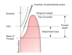 Flap dan Cangkok Gingiva
