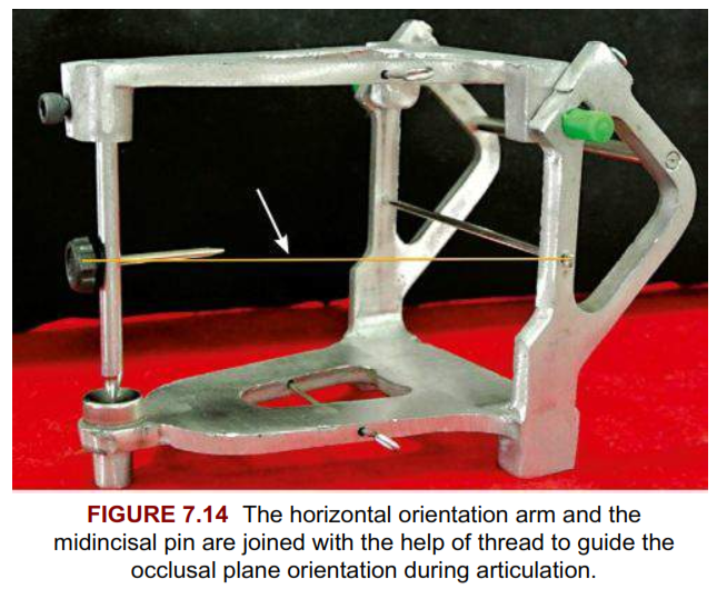 Articulator Mounting