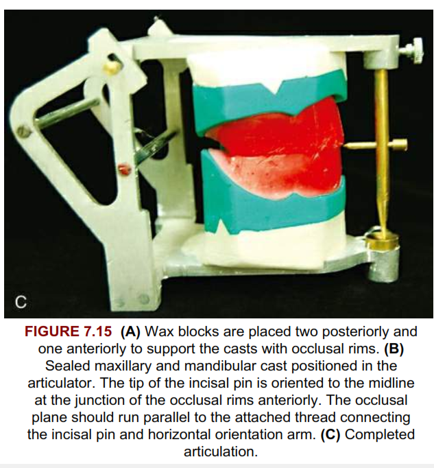 Articulator Mounting