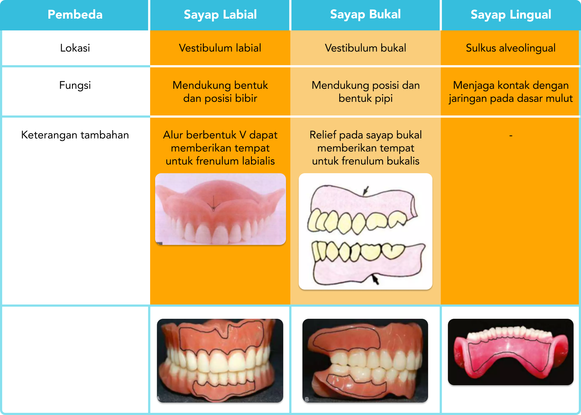 Pengenalan Gigi Tiruan Lengkap (Full Denture)