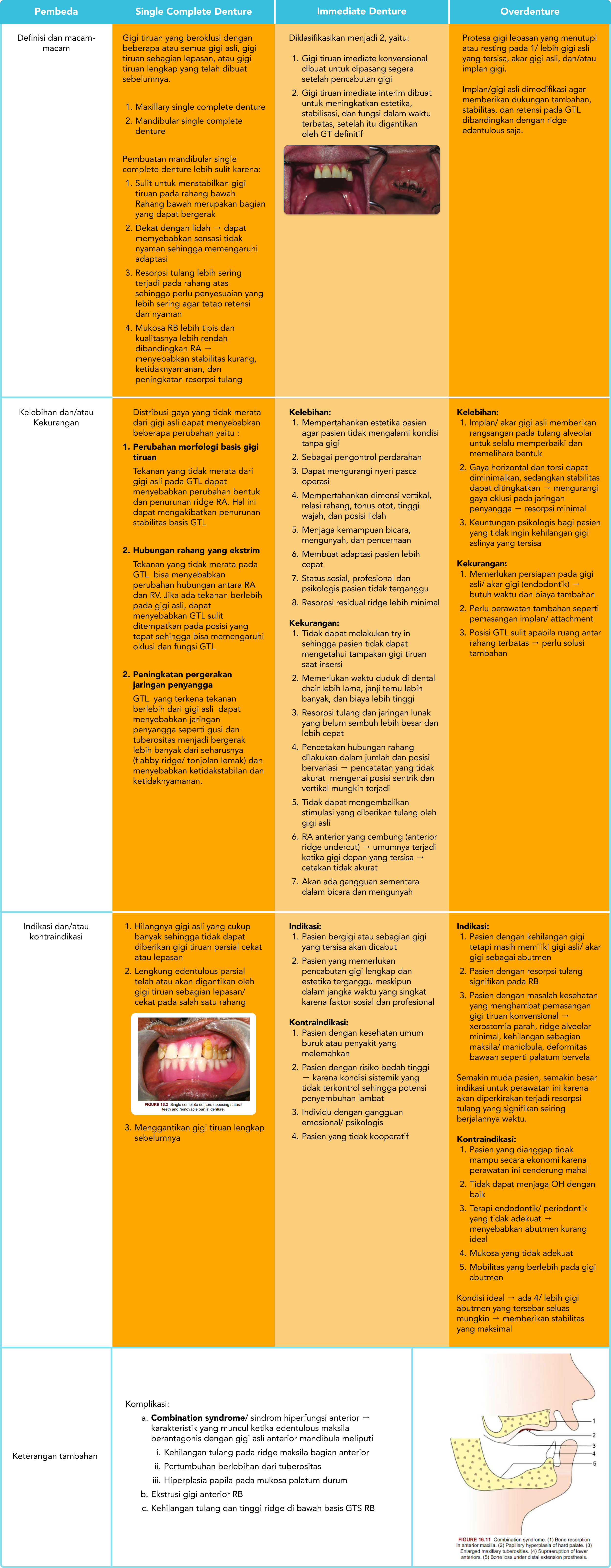 Pengenalan Gigi Tiruan Lengkap (Full Denture)