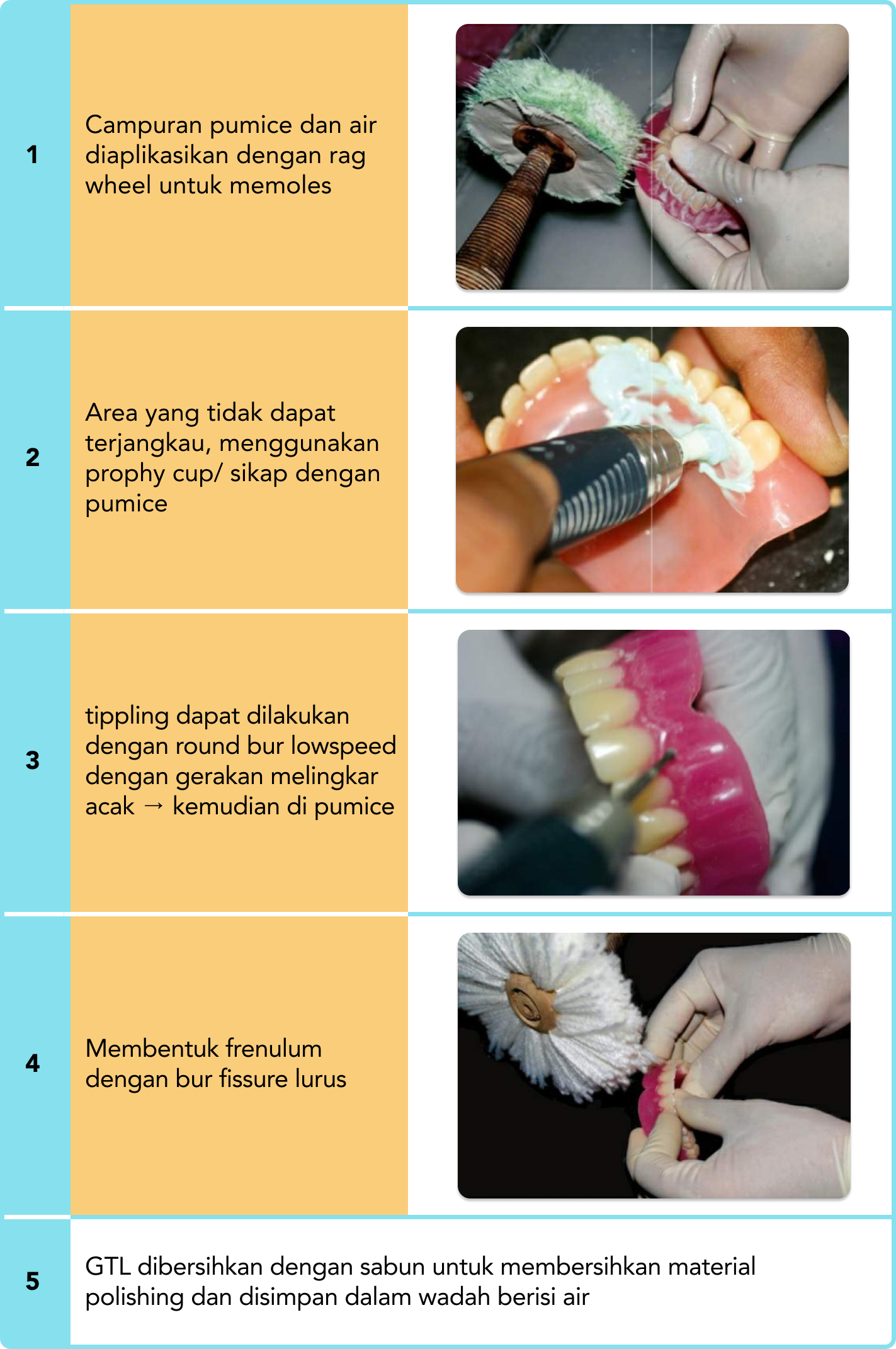 Pengenalan Gigi Tiruan Lengkap (Full Denture)