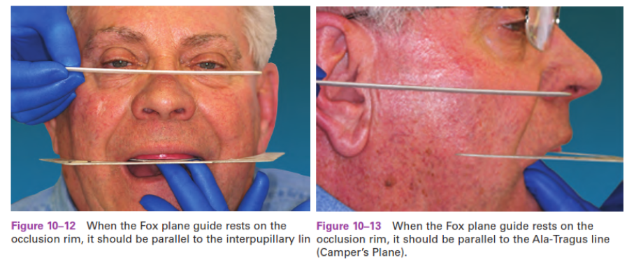 Pengenalan Gigi Tiruan Lengkap (Full Denture)