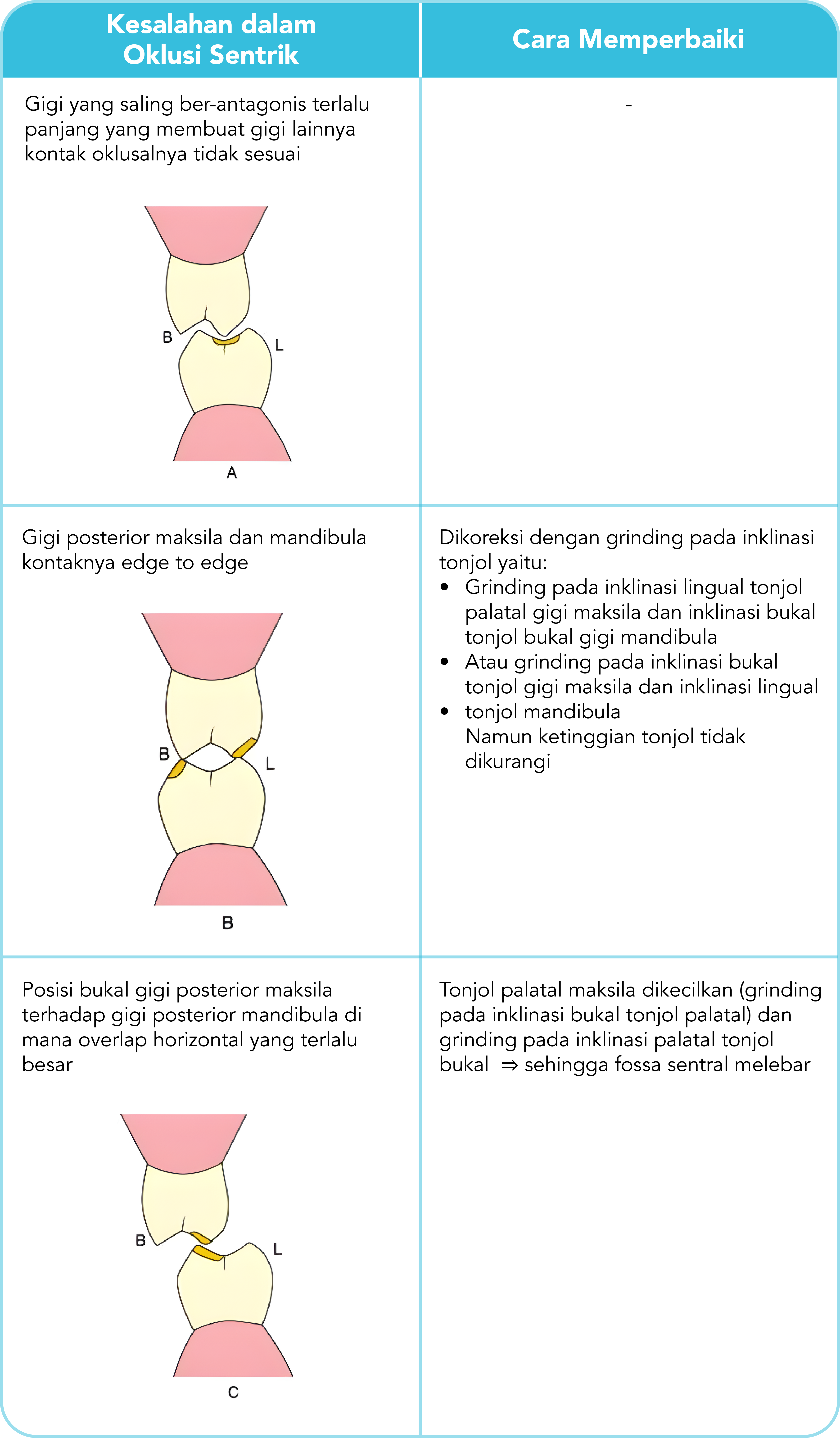 Insersi dan Penyesuaian Oklusi