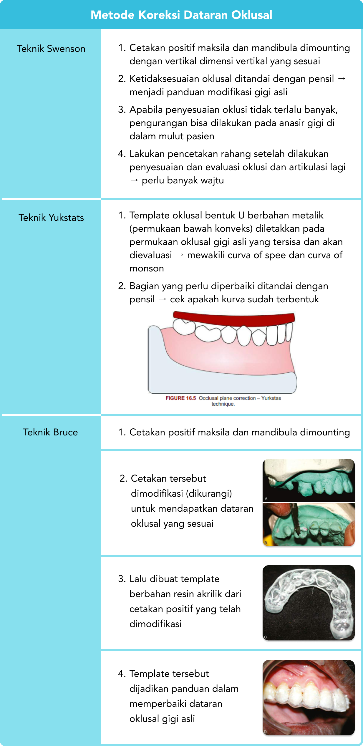 Single Complete Denture