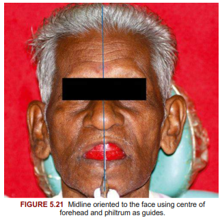 Pengenalan Gigi Tiruan Lengkap (Full Denture)