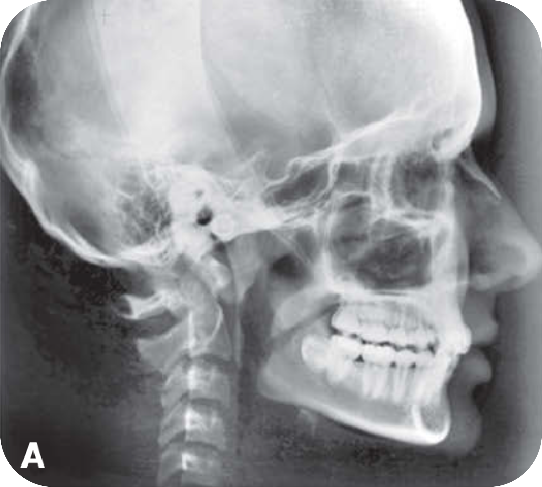 Radiografi Ekstraoral Kepala, Skull Projection, CBCT