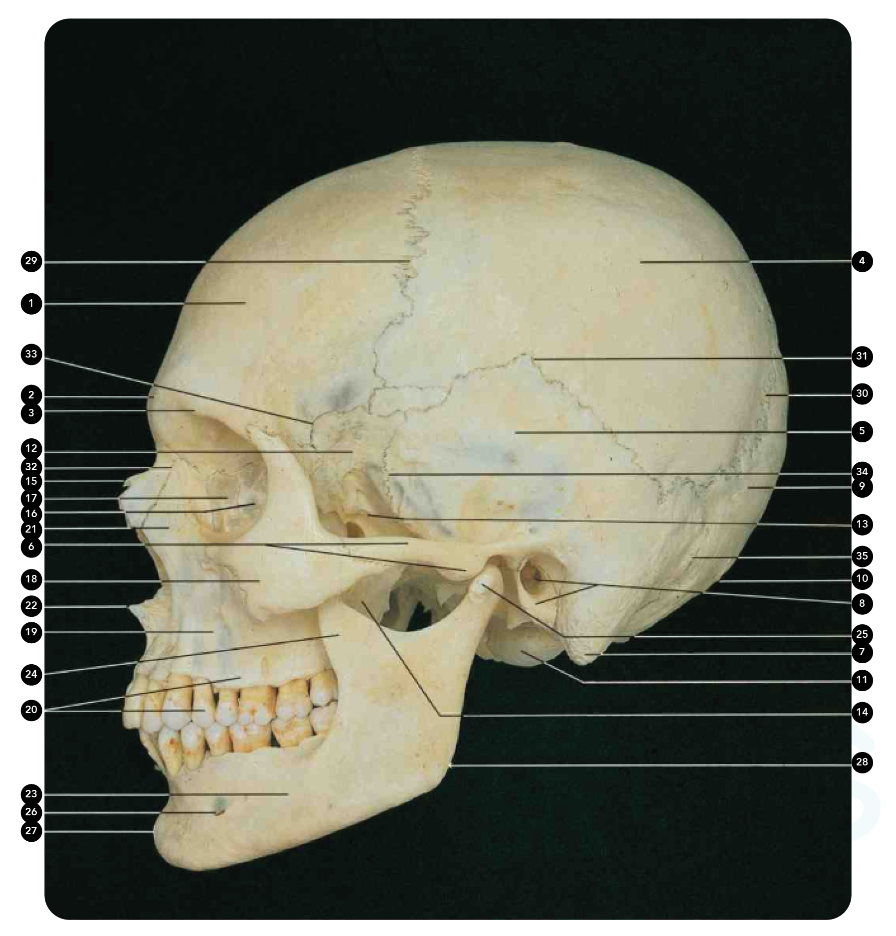 Anatomi Cranium