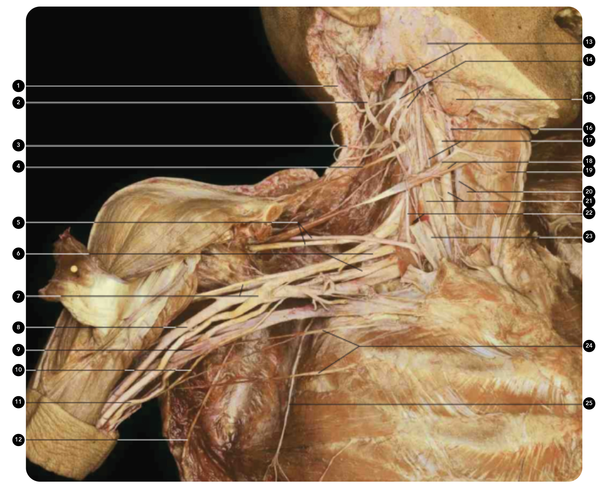 Inervasi Kepala Leher