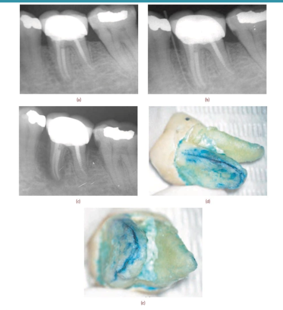 Kegawatdaruratan Endo-Resto