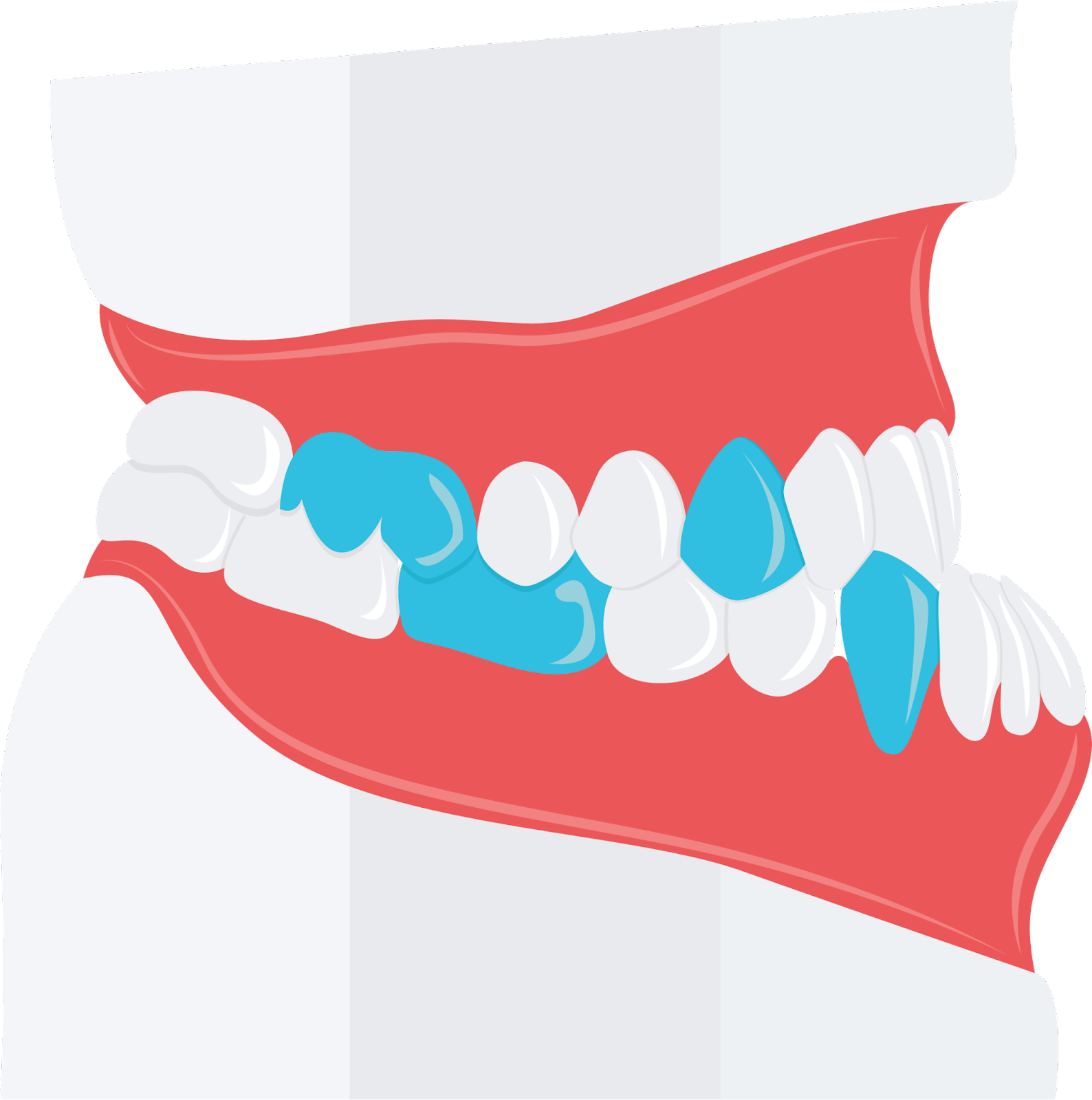 Diagnosis Maloklusi Dan Macam Perawatannya