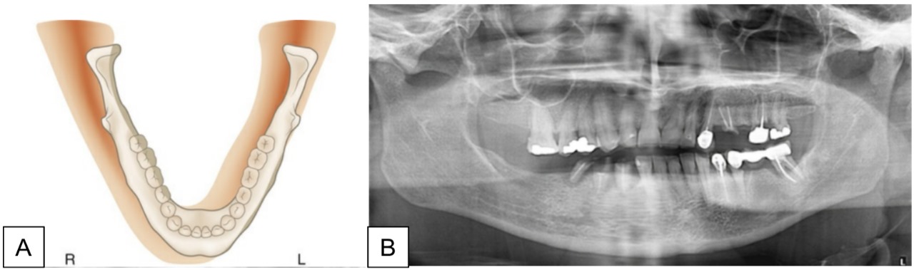 Kupas Tuntas Teknik Rontgen Panoramik!