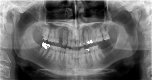Kupas Tuntas Teknik Rontgen Panoramik!