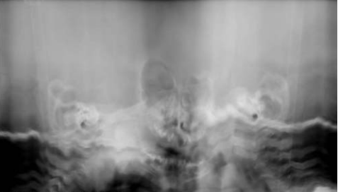 Kupas Tuntas Teknik Rontgen Panoramik!