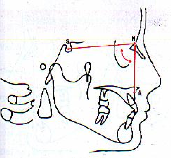 Kupas Tuntas Anatomical Landmark Sefalometri