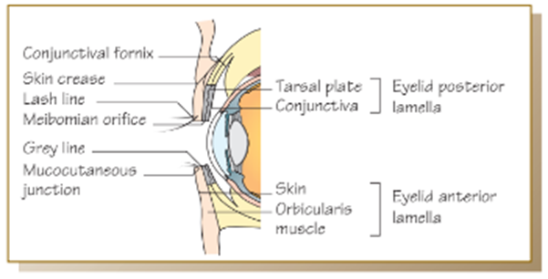 Perdarahan Subconjunctiva